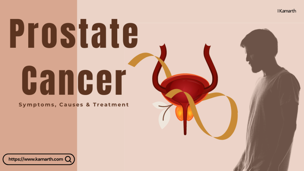 prostate cancer: symptoms, causes and treatment